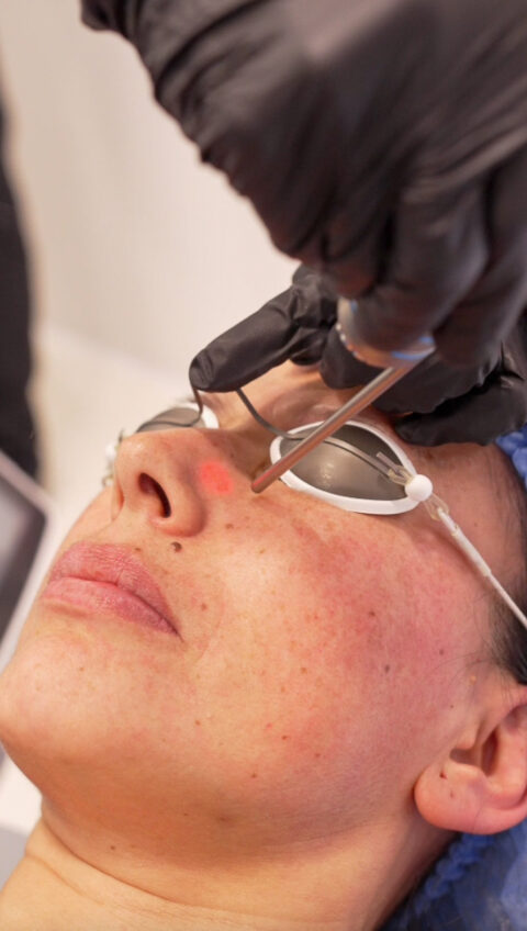 Láser Fotona StarWalker - Bojanini Colombia